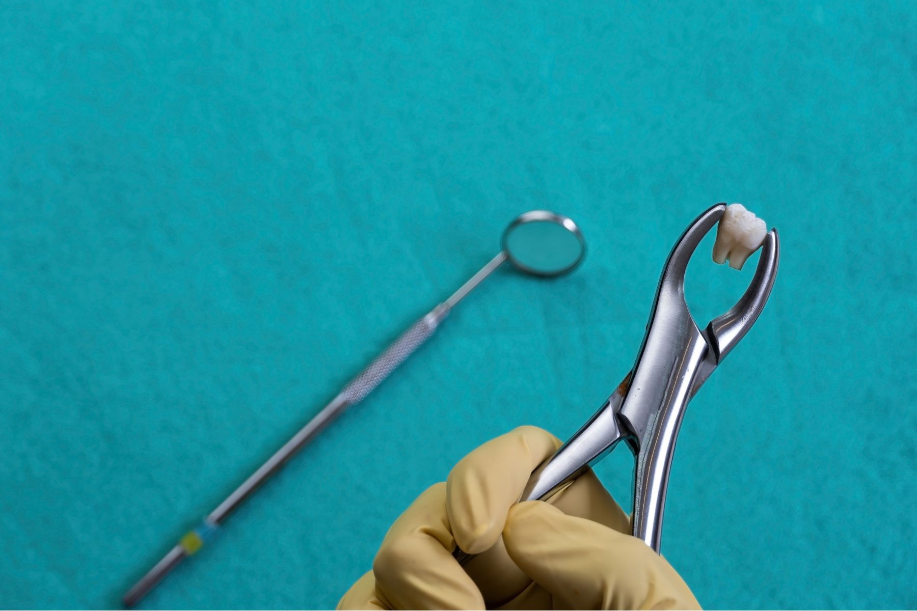 Extracciones dentales: ¿cuándo es necesario extraer?|Gallardo